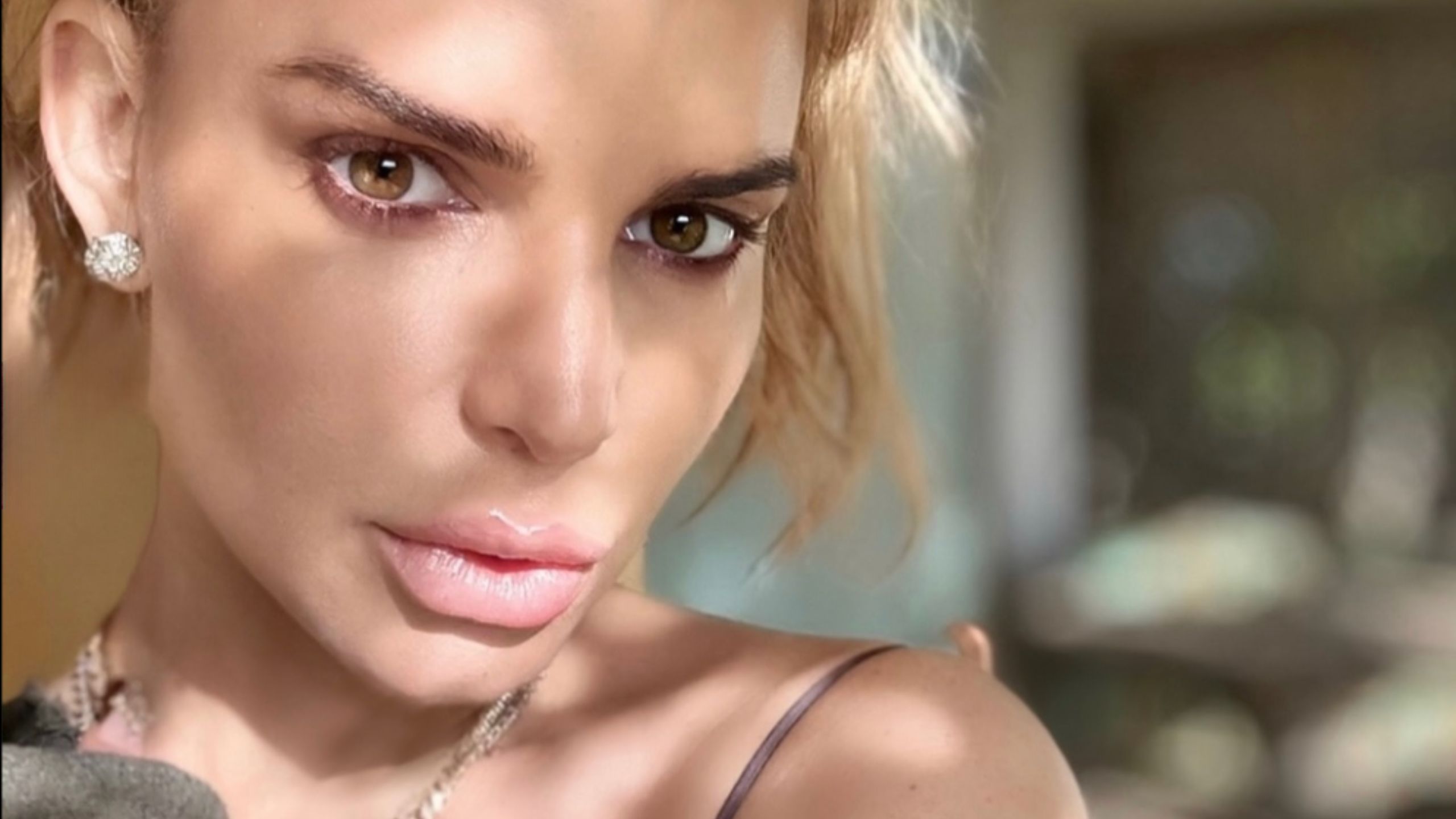 ¿Qué le pasó a la cara de Jessica Simpson? La actriz muestra el efecto ...